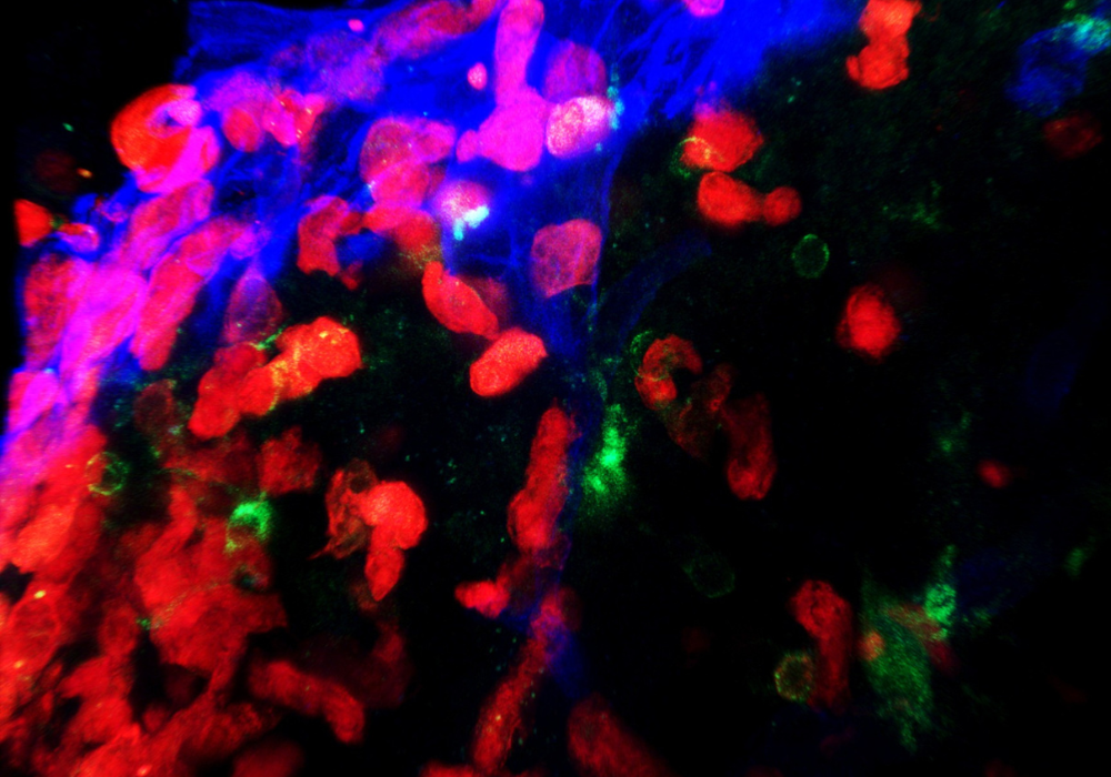 UC Irvine Study Identifies Overlooked Immune Cell Pathway Into the ...